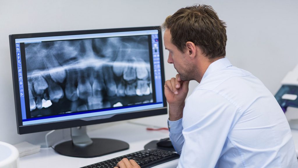 هزینه عکس دندان در سال 1404 چقدر است؟ | هزینه با بیمه تامین اجتماعی و تکمیلی - implantdr