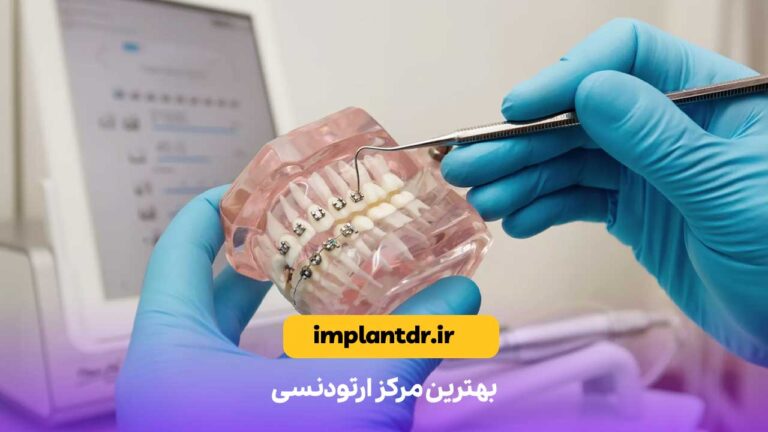 لیست بهترین مرکز ارتودنسی در تهران (6 کلینیک برتر ارتودنسی) - implantdr
